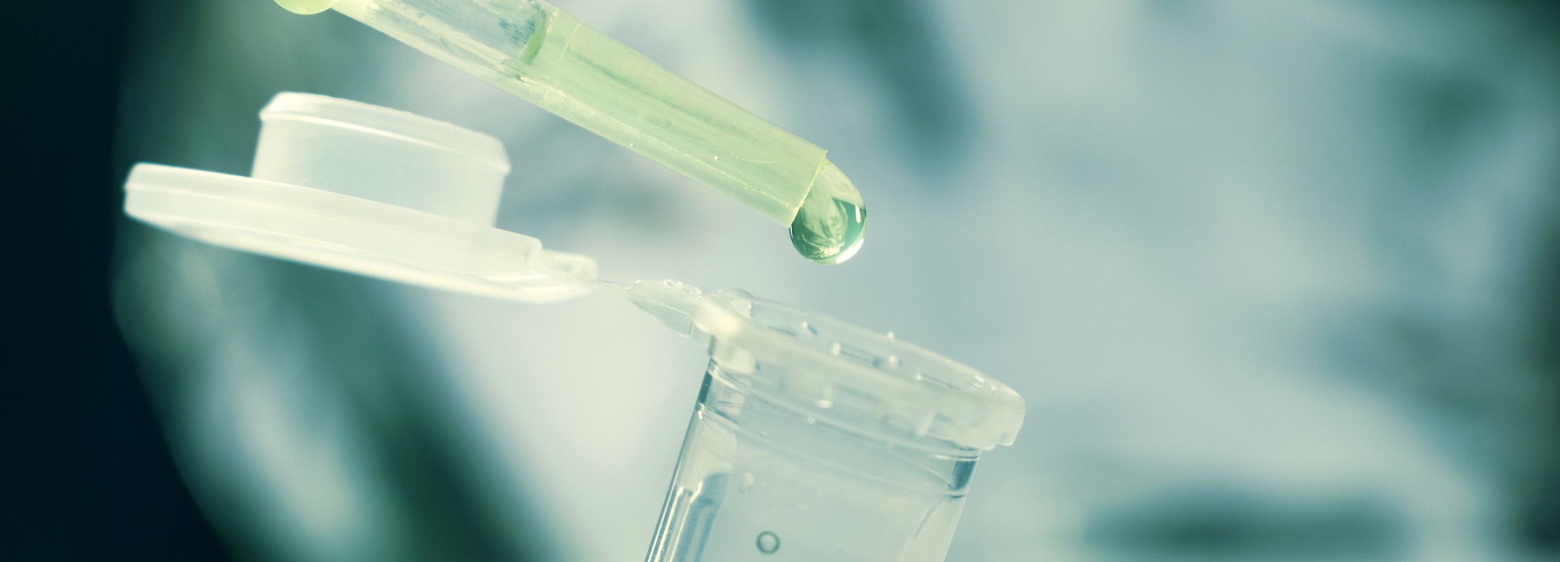 Stamceltransplantaties bij snel progressieve diffuse cutane Systemische ...